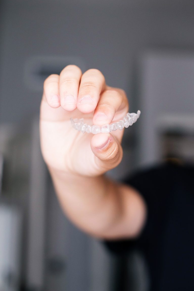 5 Tips to Get Your Teen Through Invisalign® Treatment — All for the Boys